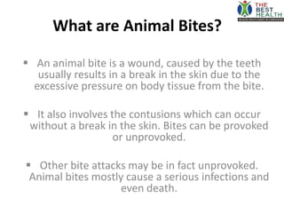 Animal Bites Causes Symptoms Treatment | PPTX