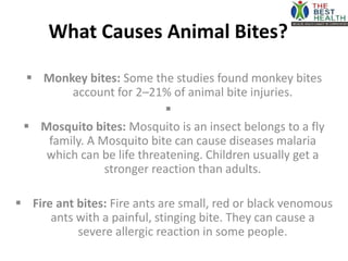 Animal Bites Causes Symptoms Treatment | PPTX
