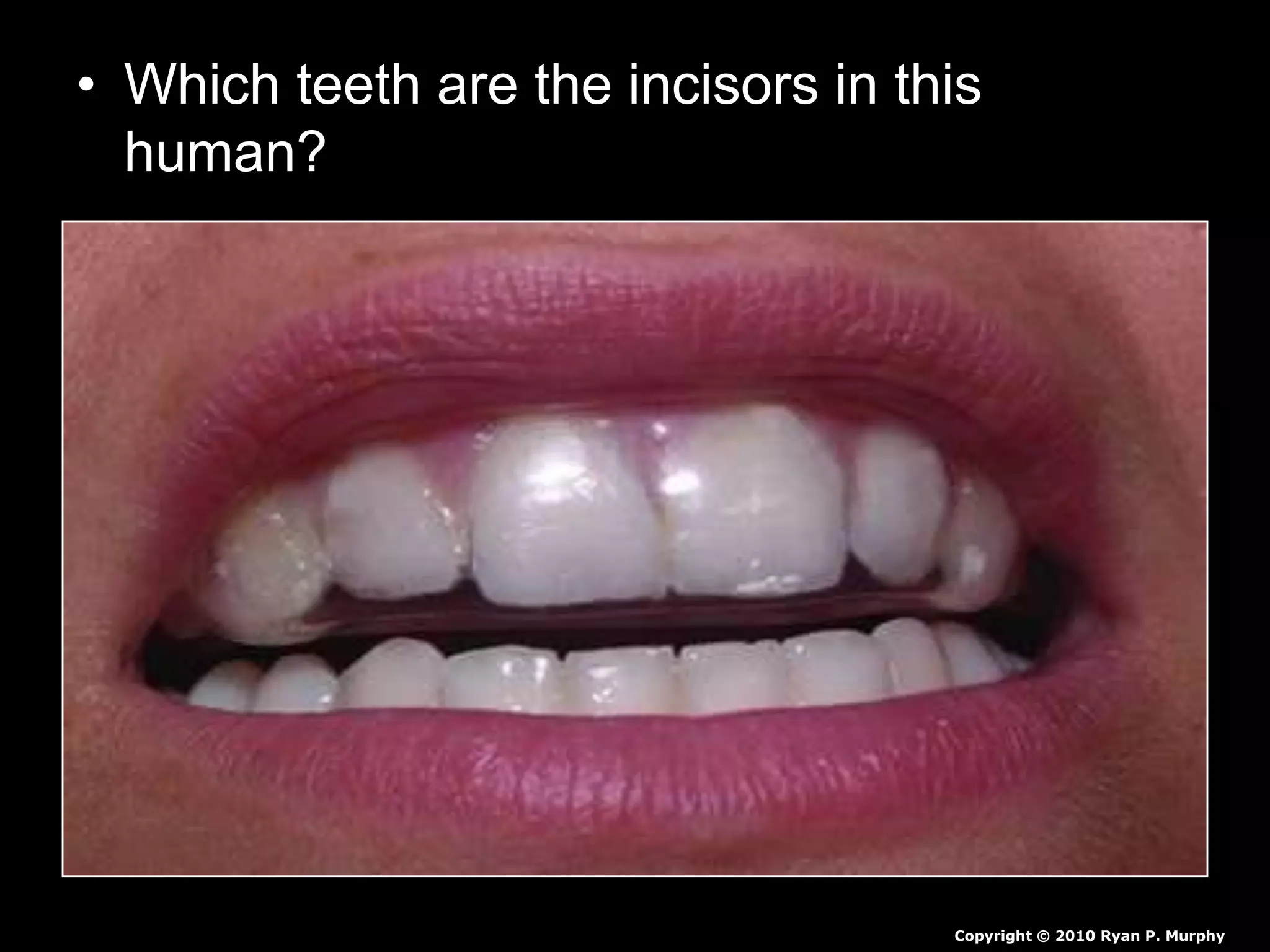 Animal Dentition Lesson PowerPoint, Teeth, Quiz, Types of Teeth | PPTX