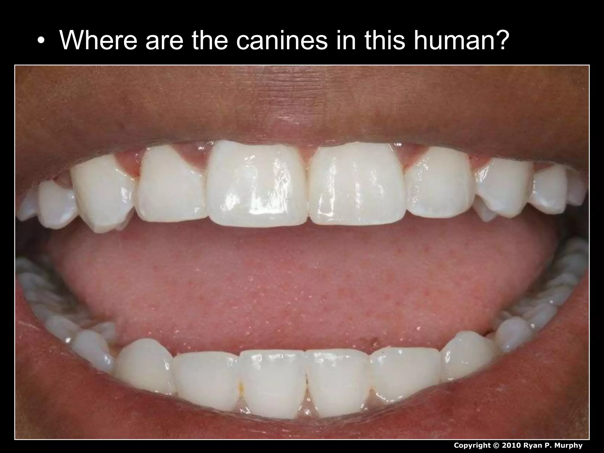 Animal Dentition Lesson PowerPoint, Teeth, Quiz, Types of Teeth | PPTX
