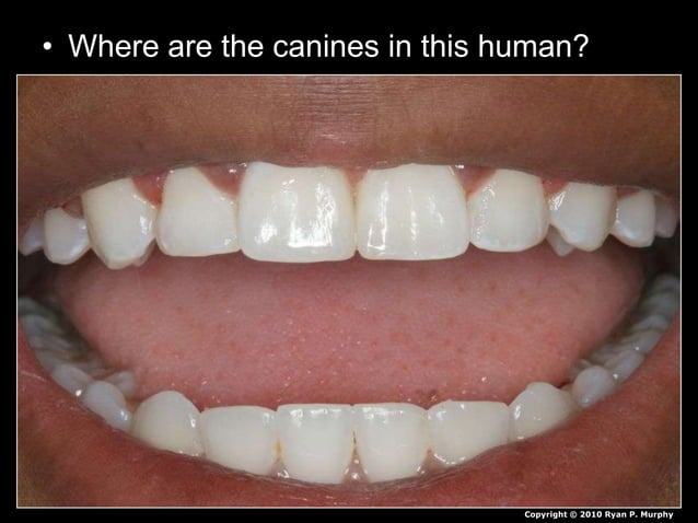 Animal Dentition Lesson PowerPoint, Teeth, Quiz, Types of Teeth | PPTX