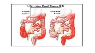 Animal models of ibd | PPTX