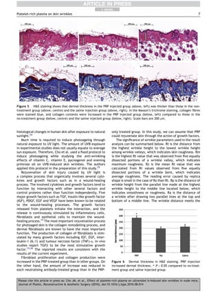 PRP Animal study | PDF