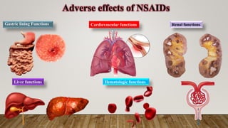 animated presentation on NSIDs.pptx