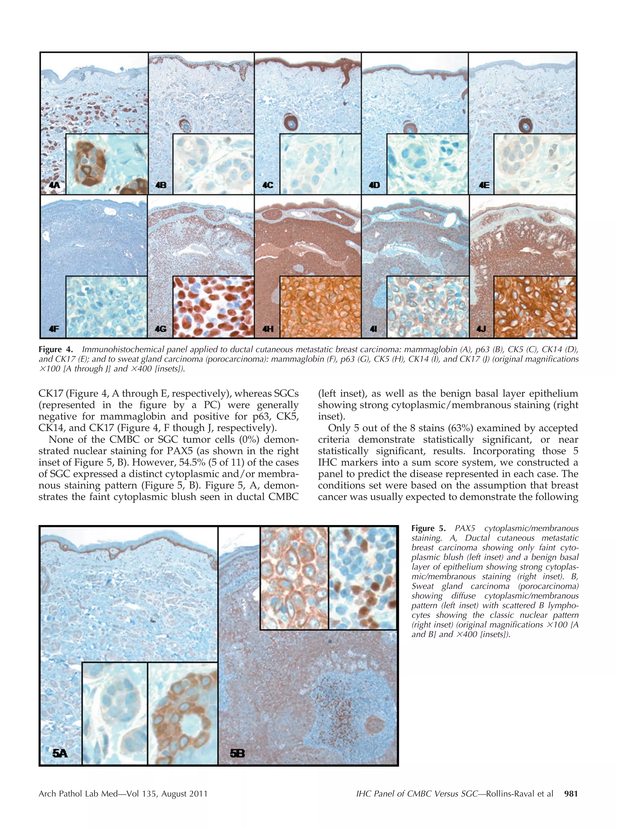 An immunohistochemical panel to differentiate | PDF