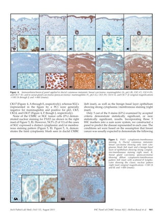 An immunohistochemical panel to differentiate | PDF