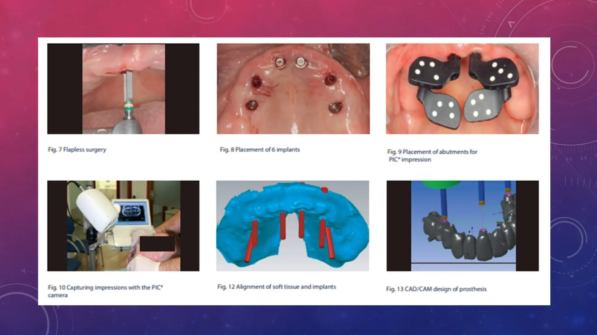 An insight into intraoral scanner technology | PPTX