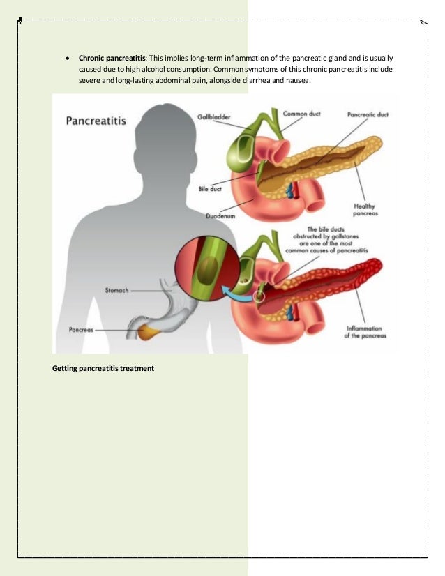 An Insight into the Types of Pancreatitis | PDF