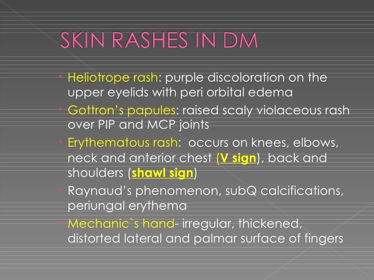 A Case of Dermatomyositis
