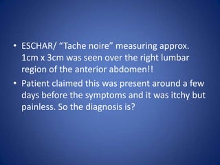 An interesting fever | PPTX