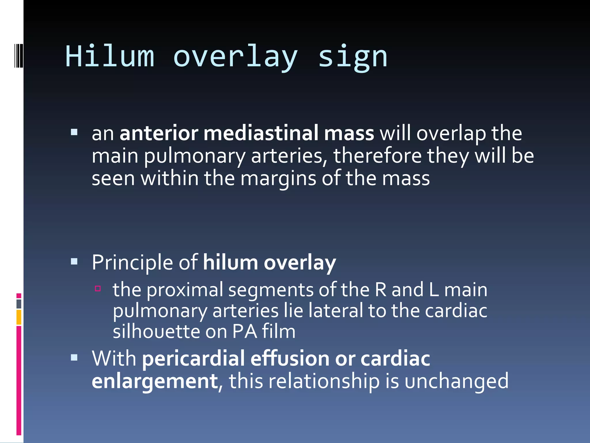 CXR: Lung Mass - Mediastinal Mass | PPT
