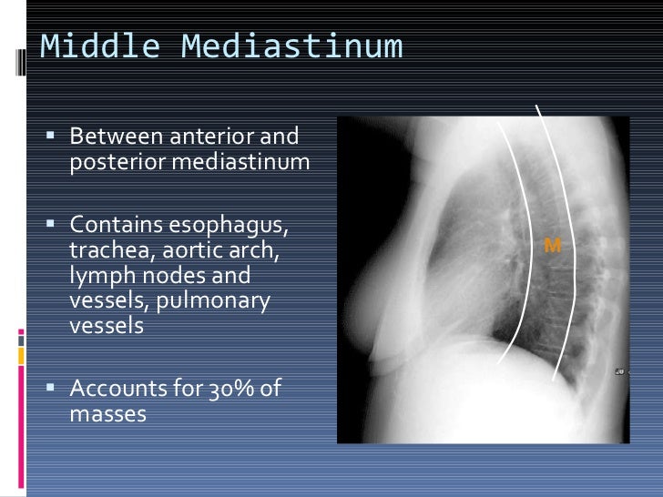 Cxr Lung Mass Mediastinal Mass