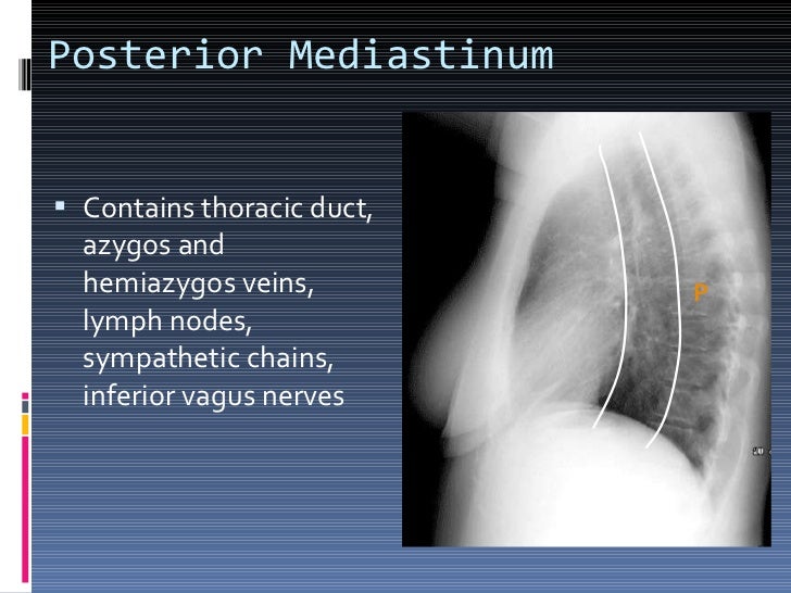 Cxr Lung Mass Mediastinal Mass
