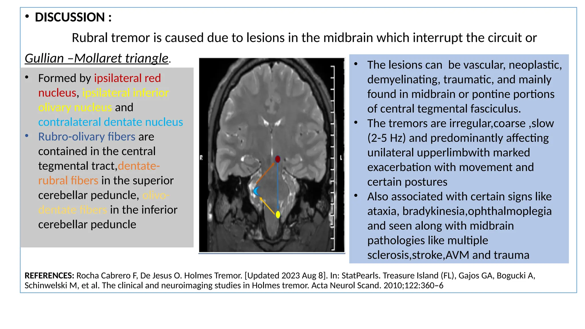 An intresting case of tremor , rubral tremor | PPTX