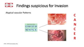 An Introduction to Colposcopy Grothuesmann | PPTX