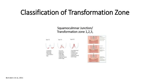 An Introduction to Colposcopy Grothuesmann