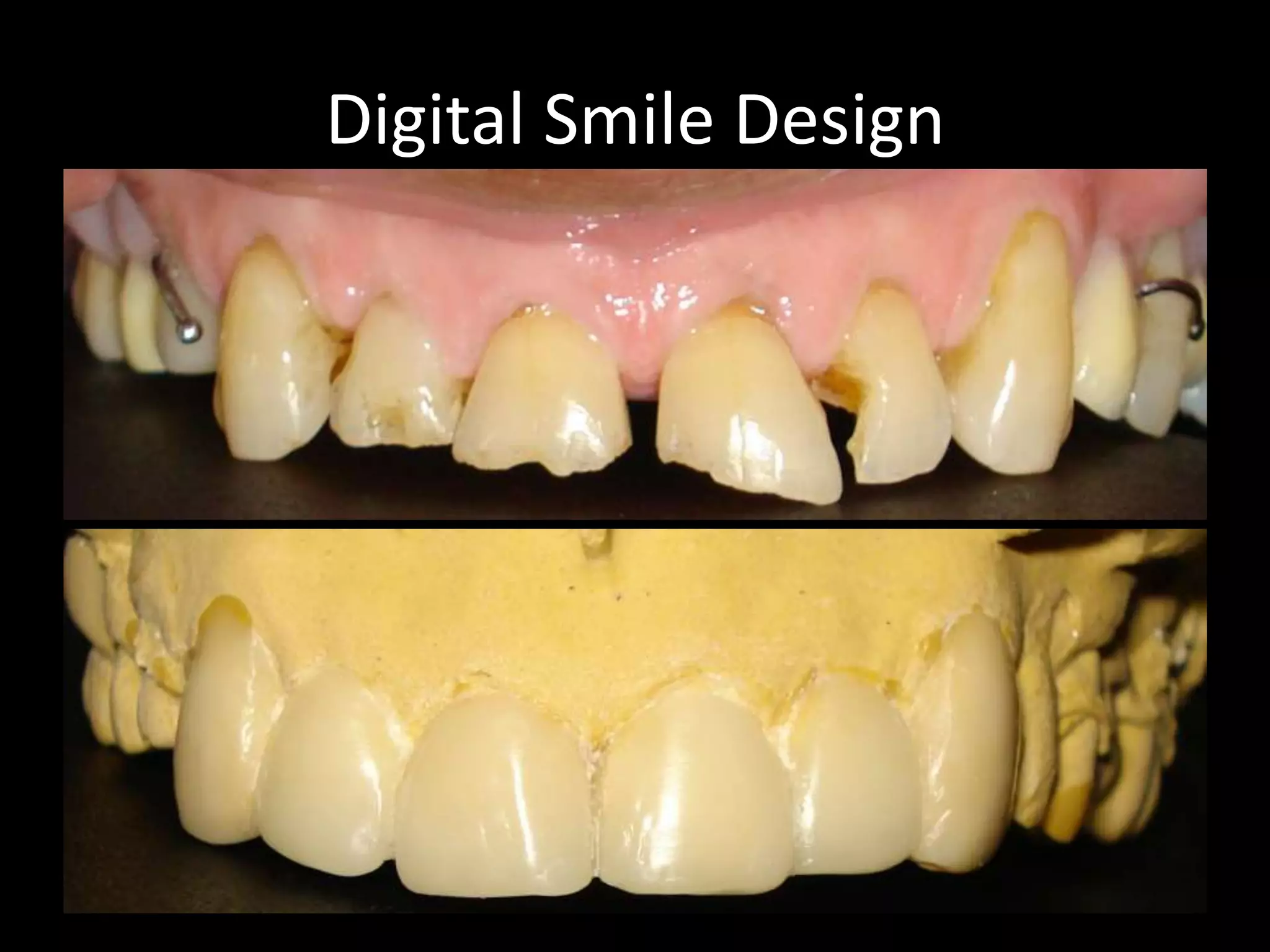 An introduction to dentistry in the digital age | PPTX