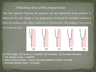 An Introduction to Fixed Prosthodontics dr. wasan.pptx