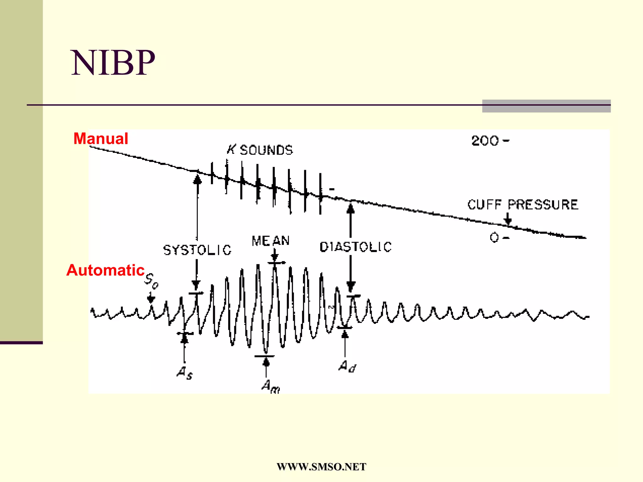 An Introduction To Surgical Icu | PPT