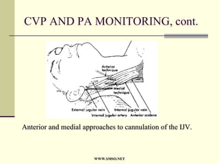 An Introduction To Surgical Icu | PPT