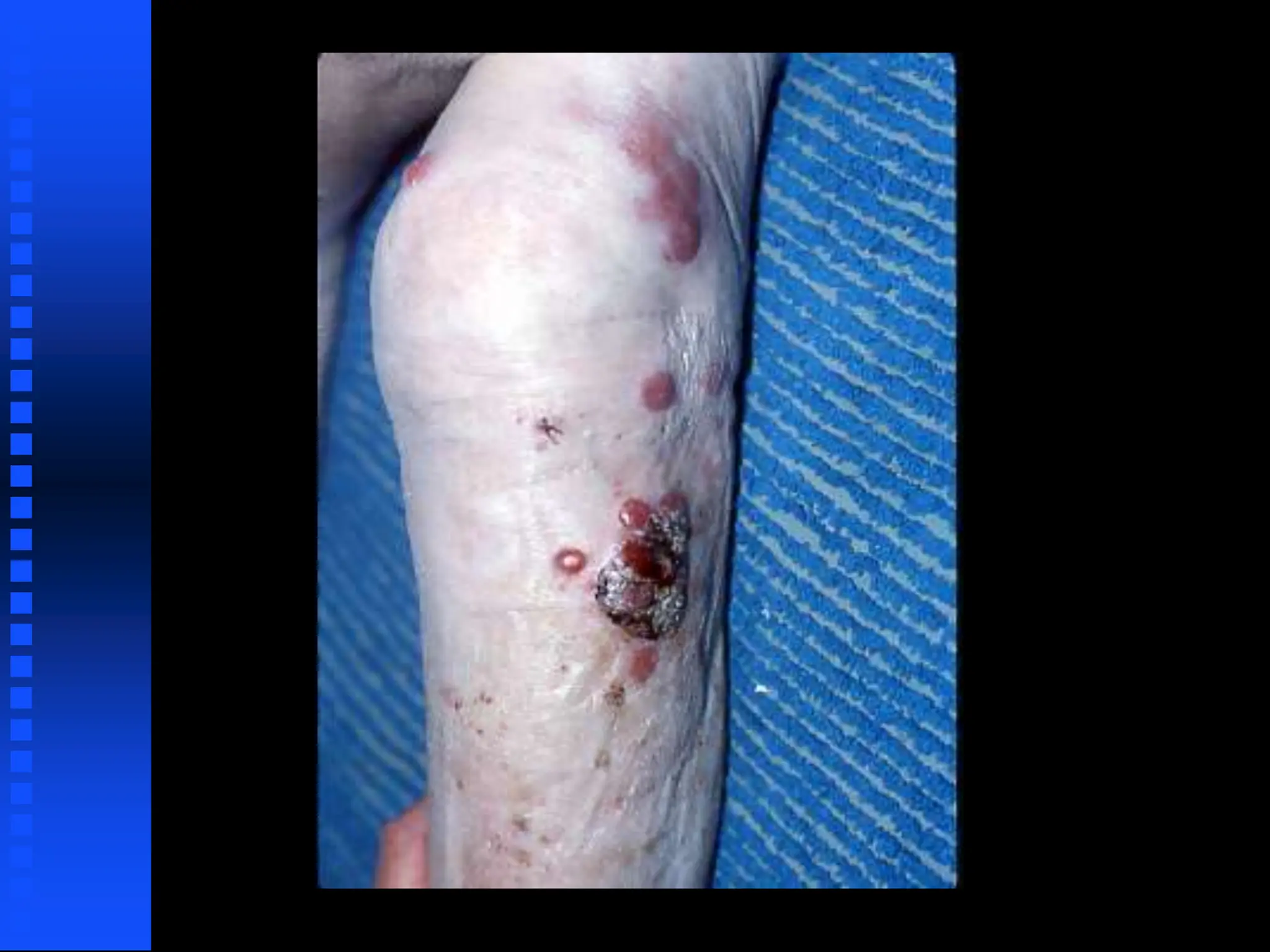 an introduction to dermatology including rash.ppt