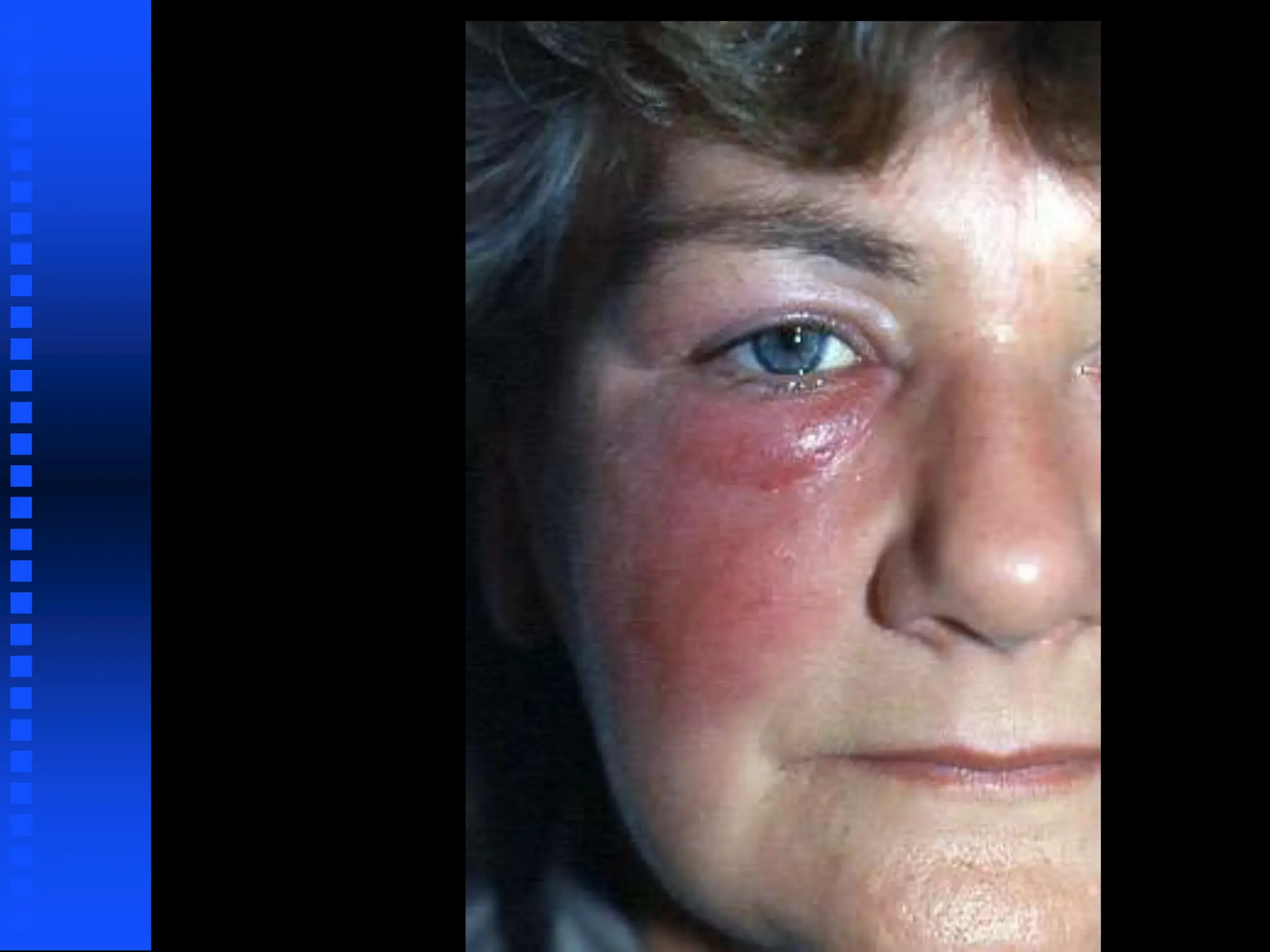 an introduction to dermatology including rash.ppt