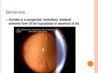 Aniridia and low vision | PPTX