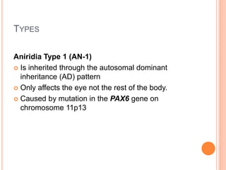 Aniridia and low vision | PPTX