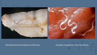 Presentación sobre anisakis desde el punto de vista parasitológico | PPTX