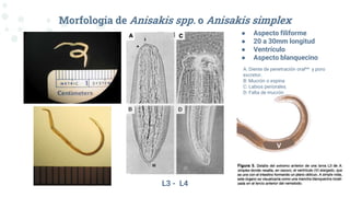 Presentación sobre anisakis desde el punto de vista parasitológico | PPTX