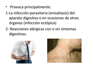 Anisakiasis | PPT