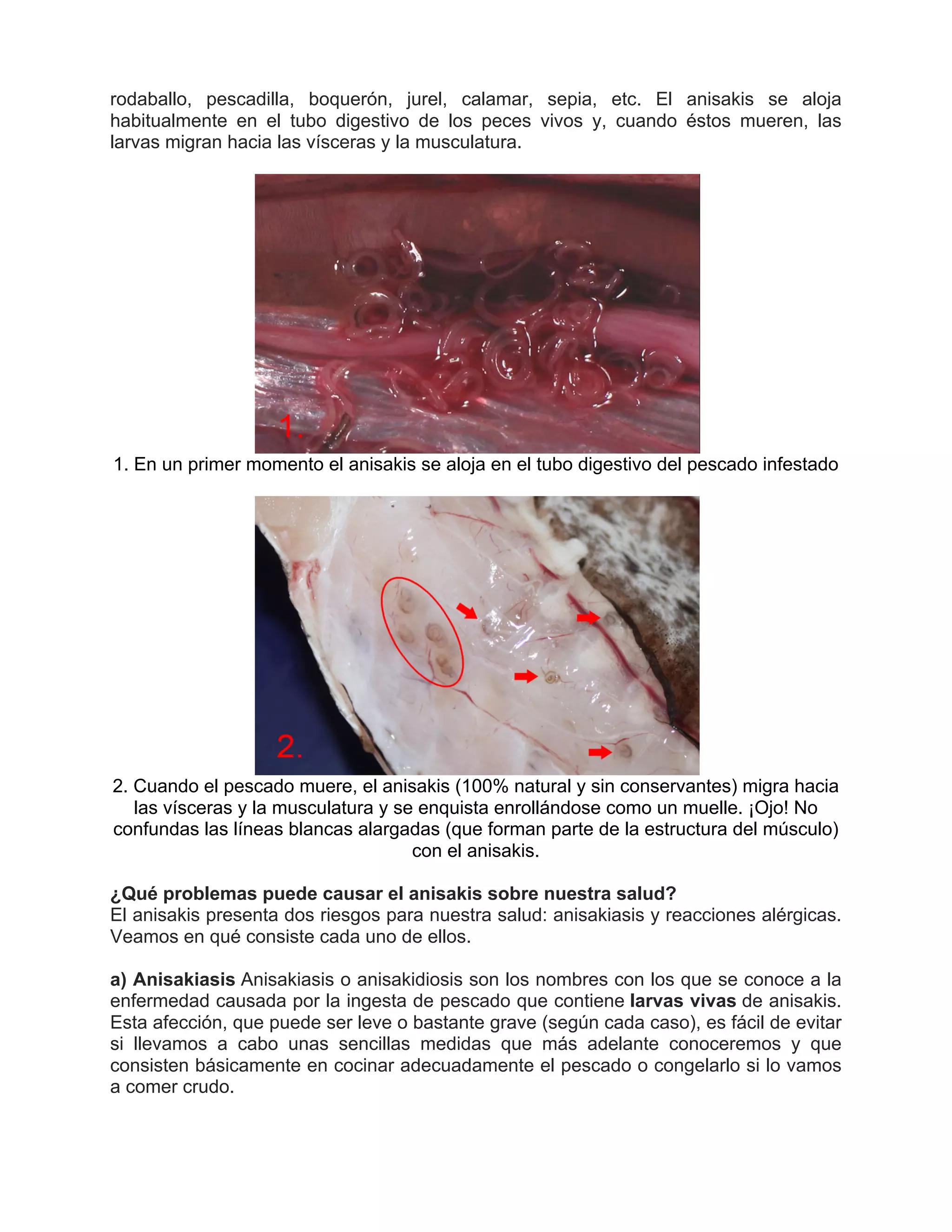 Anisakis | PDF