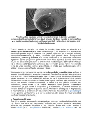 Anisakis | PDF