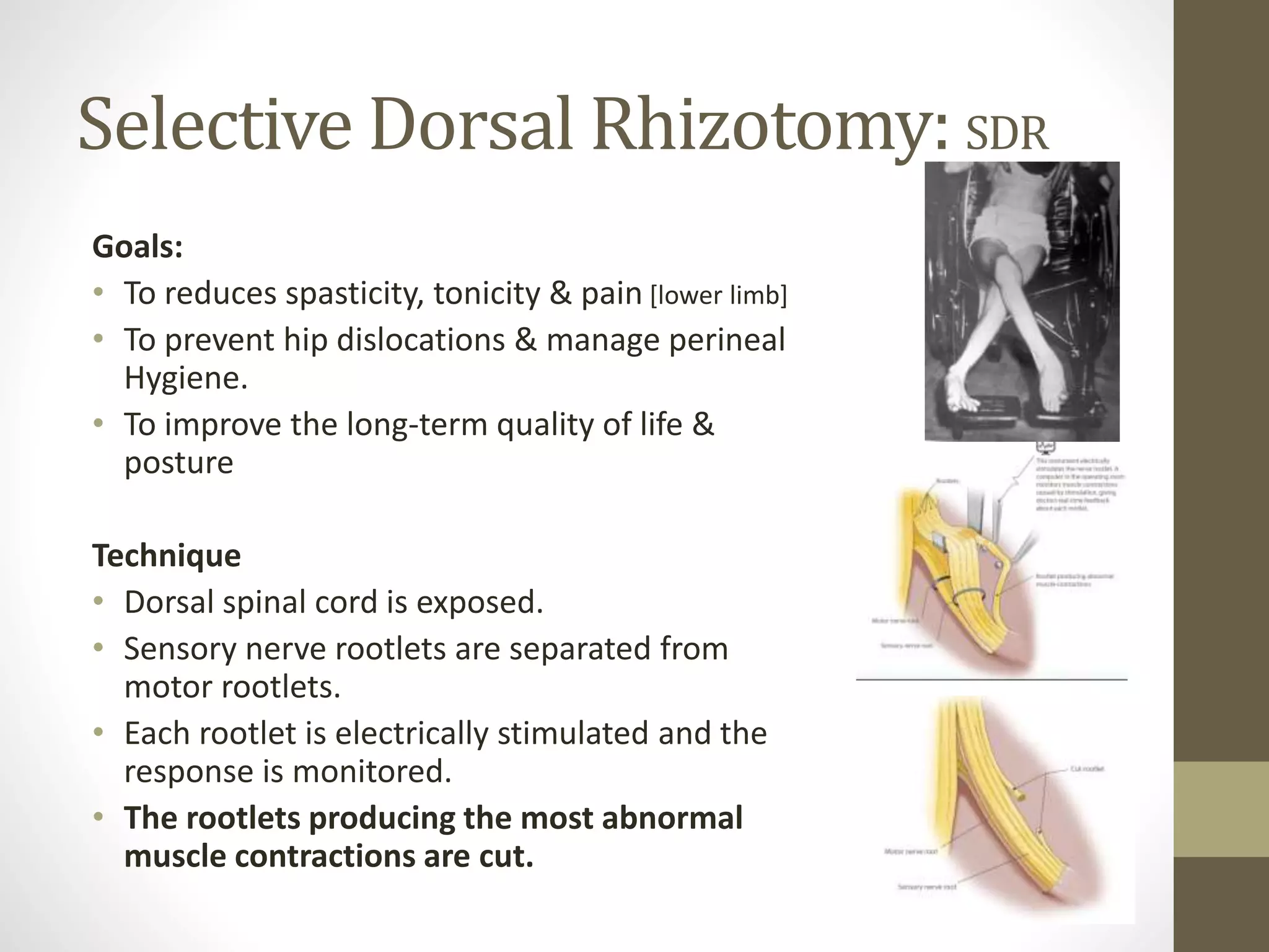 Cerebral Palsy Spasticity Management & Botox therapy | PPTX