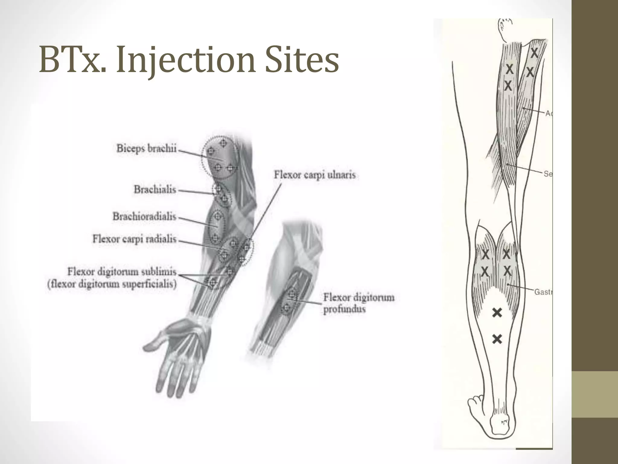 Cerebral Palsy Spasticity Management & Botox therapy | PPTX