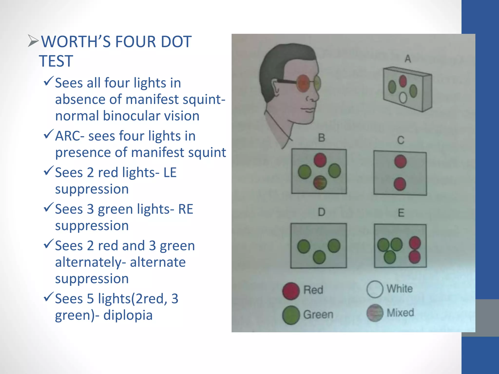 Aniseikona , anisometropia & astigmatism | PPTX