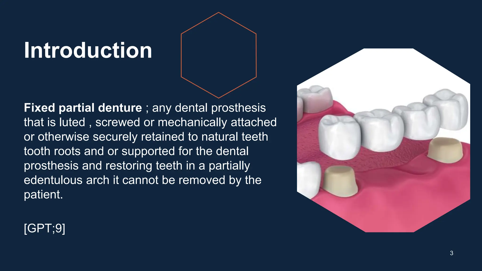 Diagnosis and treatment planning in fpd and abutment evaluation | PPTX