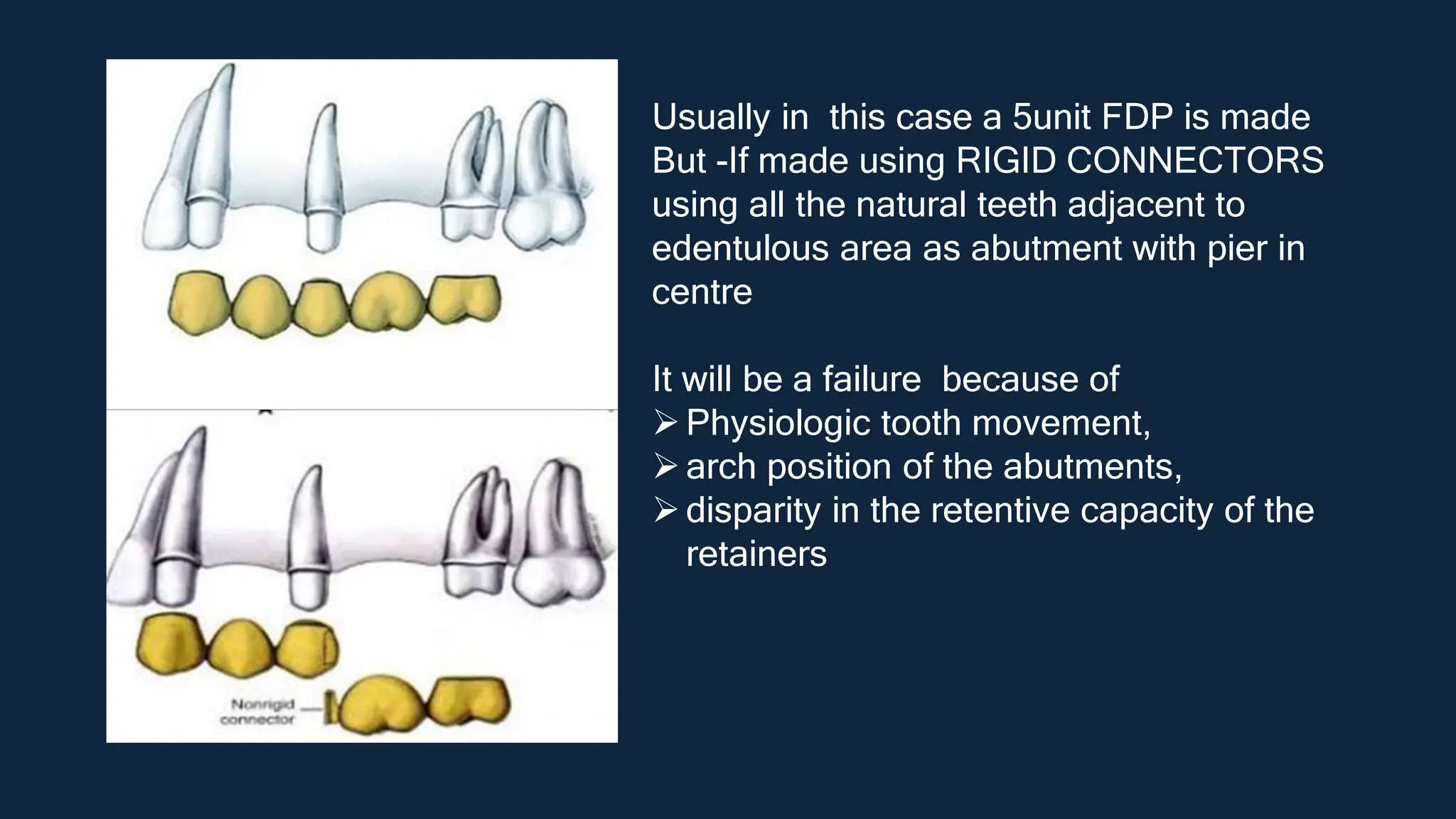 Diagnosis and treatment planning in fpd and abutment evaluation | PPTX