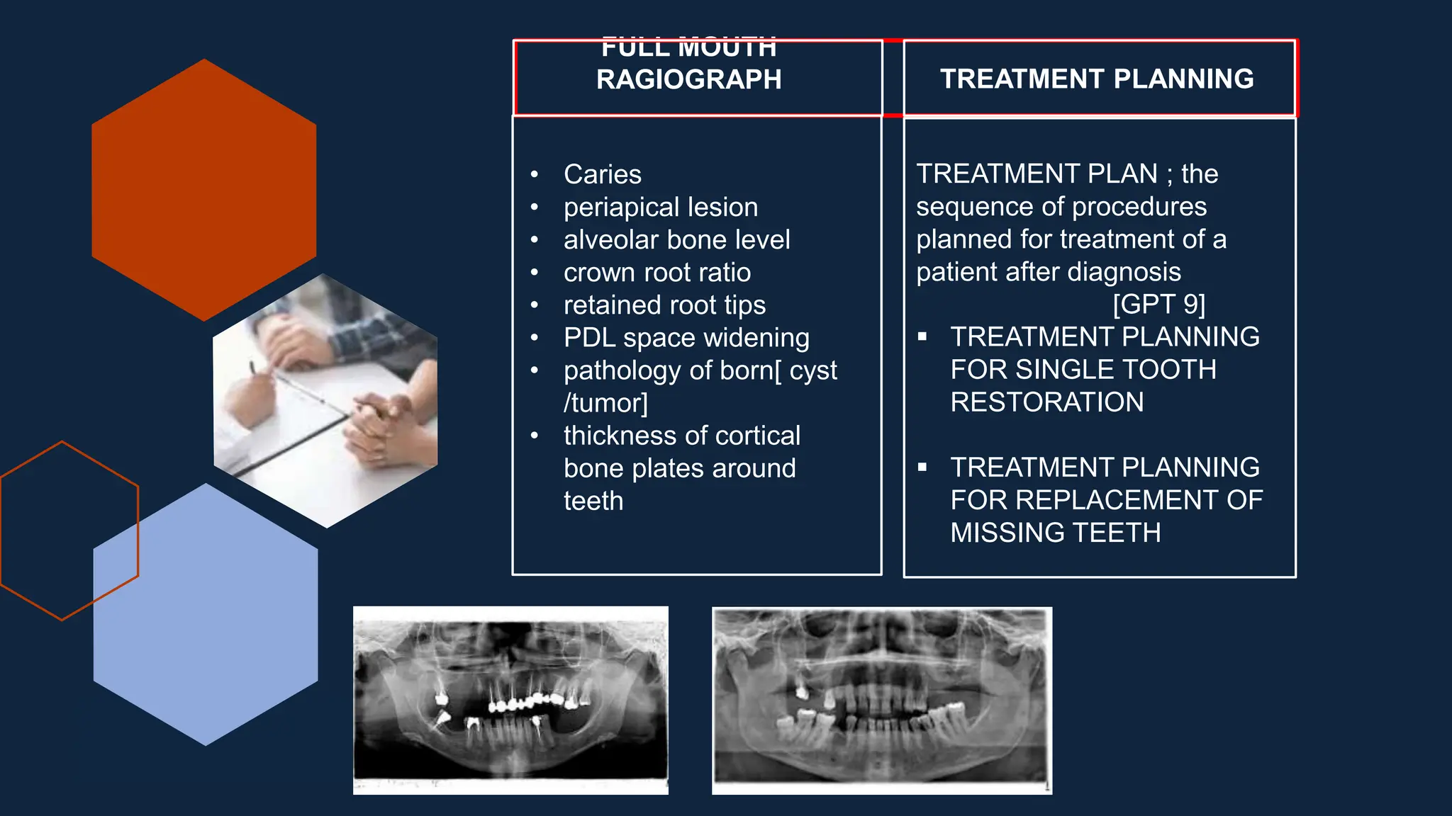 Diagnosis and treatment planning in fpd and abutment evaluation | PPTX