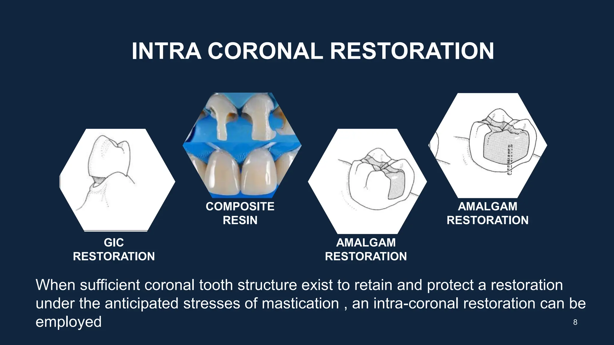 Diagnosis and treatment planning in fpd and abutment evaluation | PPTX