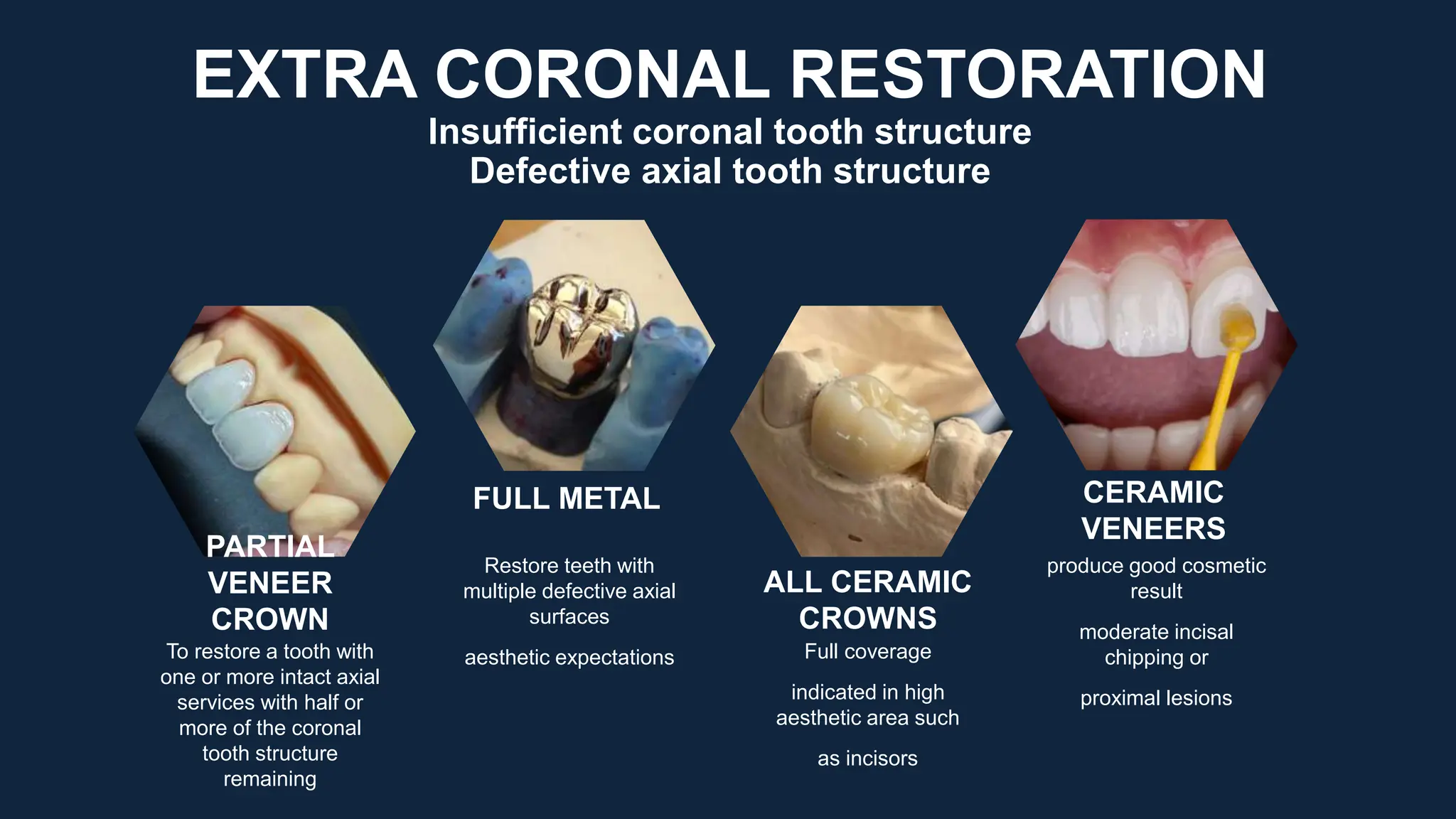 Diagnosis and treatment planning in fpd and abutment evaluation | PPTX