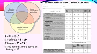 Benign Prostatic Hyperplasia (Surgical Case Presentation) | PPTX