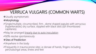 Warts (Verruca) by Dr. Aryan | PPTX