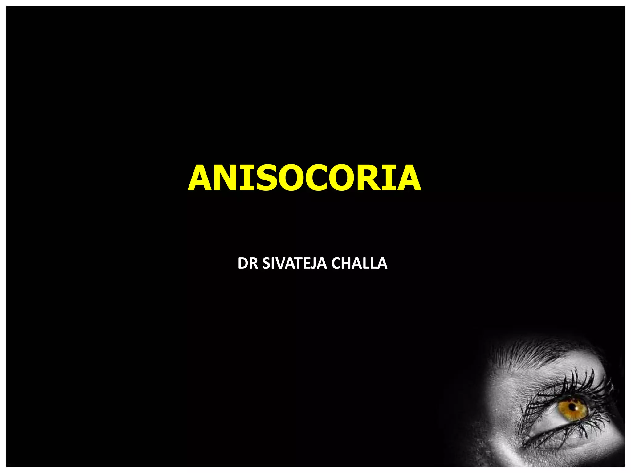 Anisocoria | PPTX