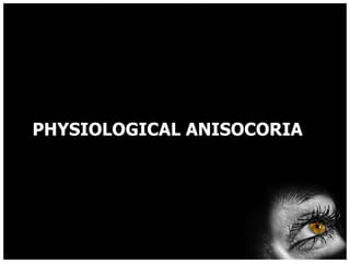 Anisocoria | PPTX
