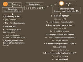 Anisocoria | PPSX
