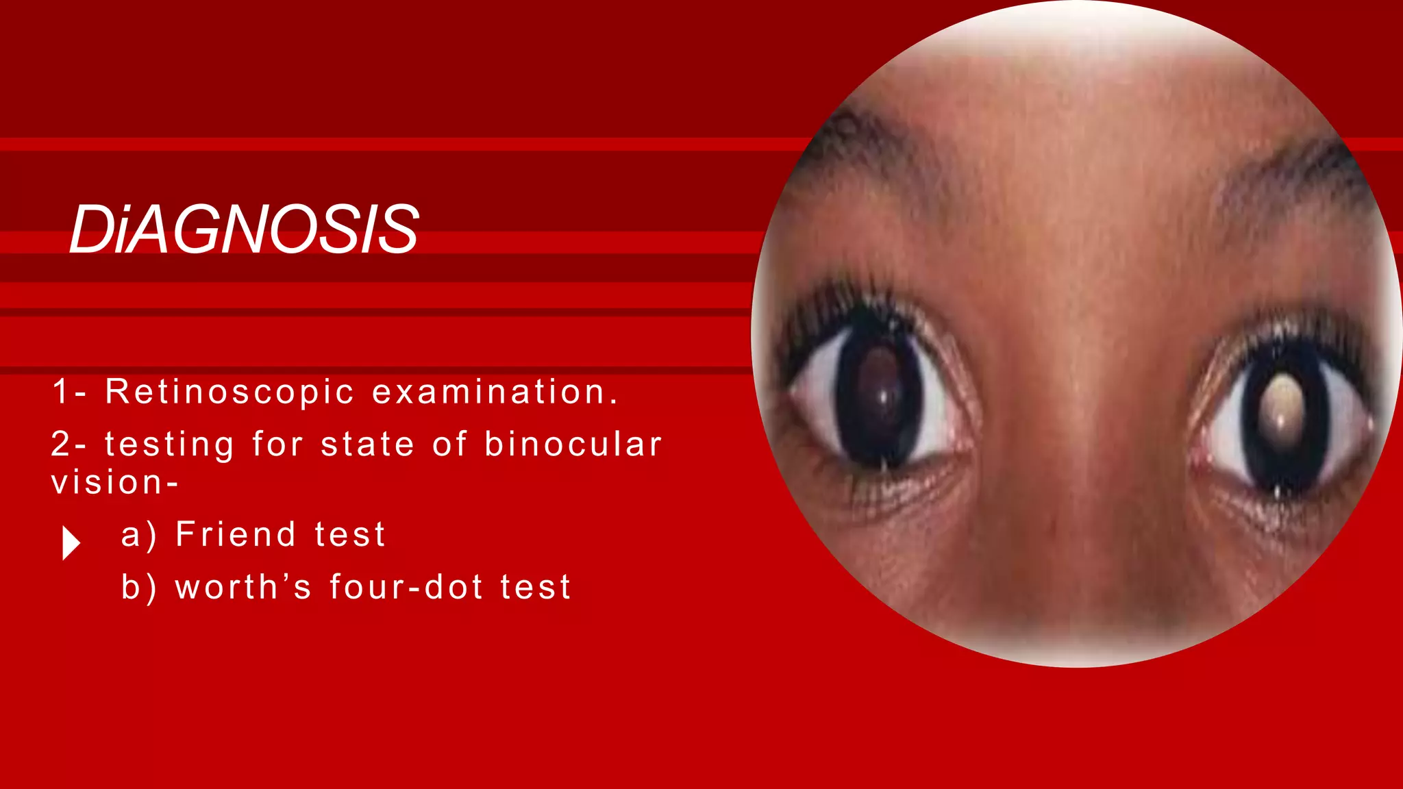 Anisometropia | PPTX