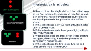Anisometropia | PPTX
