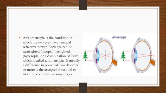 Anisometropia.pptx