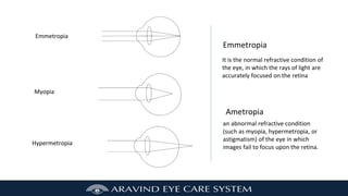 Anisometropia.pdf................................. | PDF